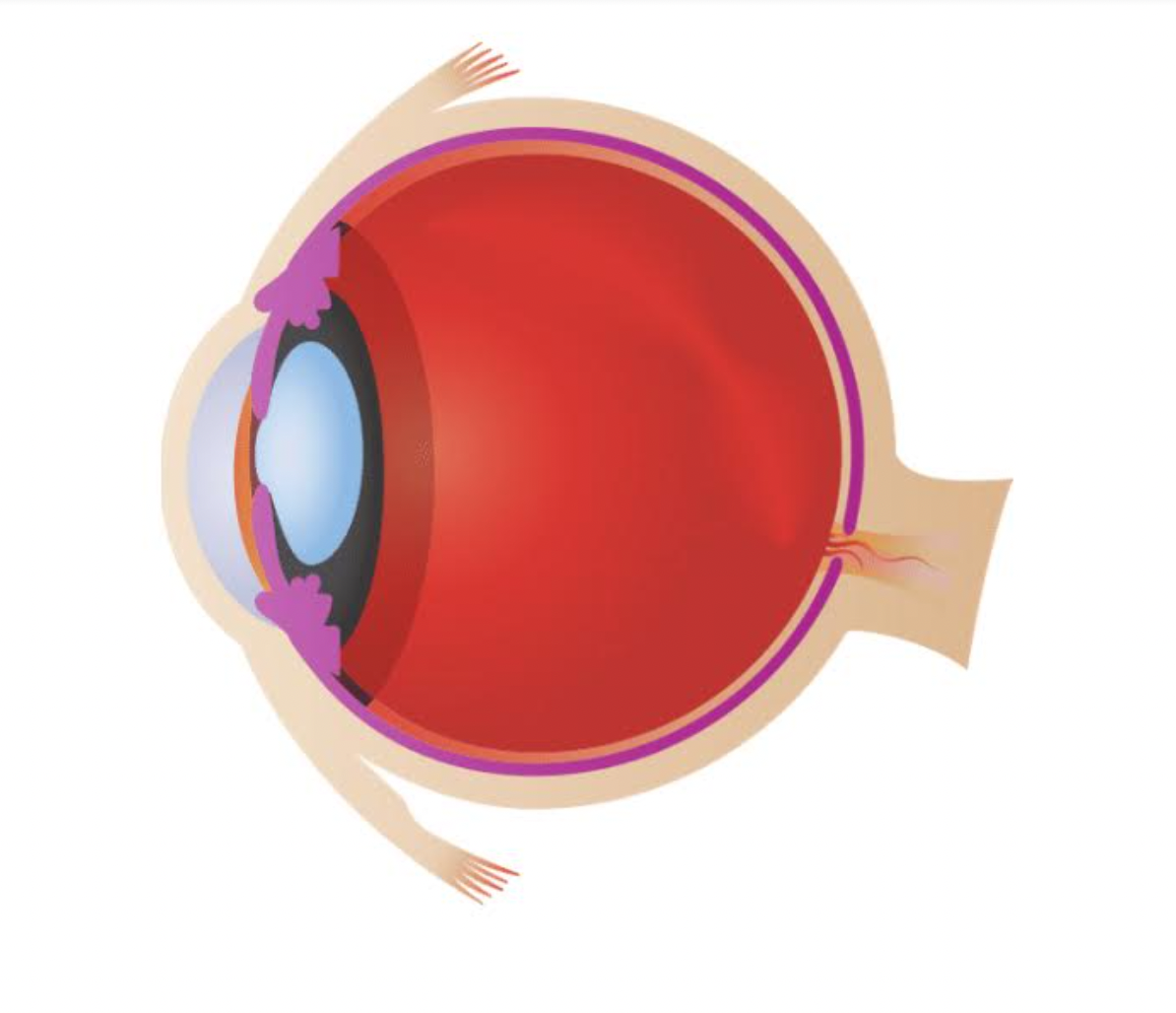 Do women with Polycystic Ovarian Syndrome (PCOS) have a greater risk of ...