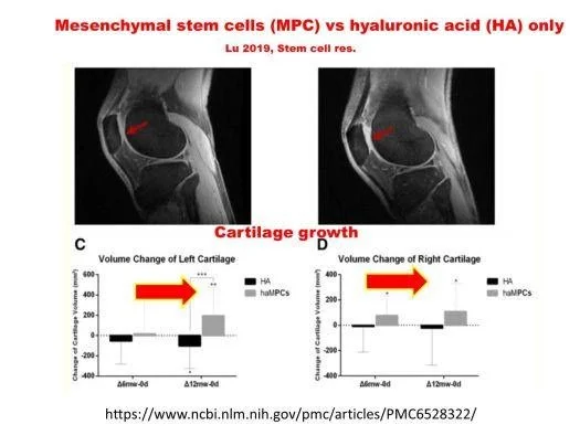 Injection-Prolo-Stem Cell Therapy — NatureWorks Acupuncture and Chinese ...
