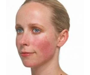 Your Skin on Exercise — scrub me™ is here to guide you on the path to ...