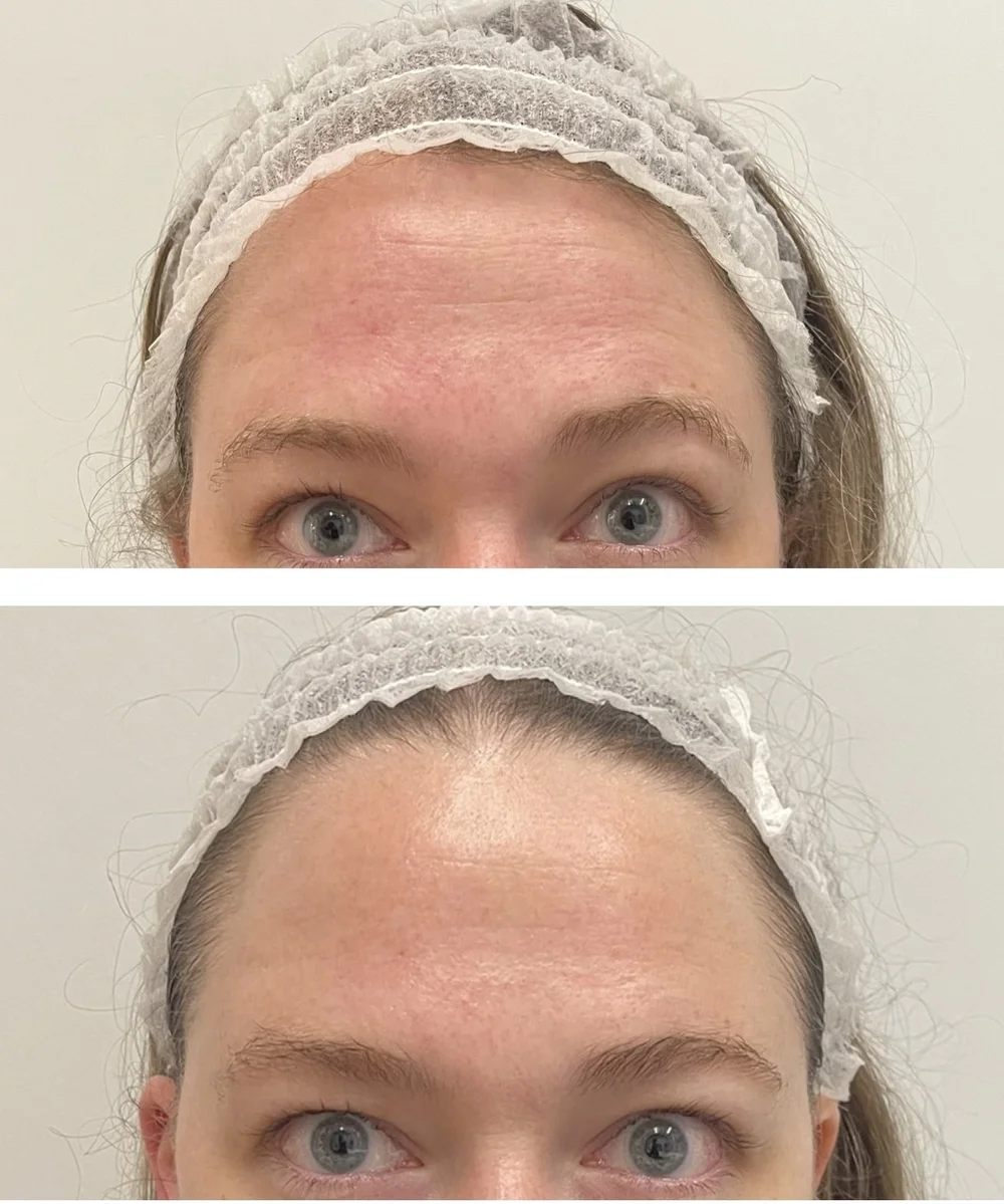 Enhance Your Skincare Routine with Gua Sha Face Massage: Expert Tips ...