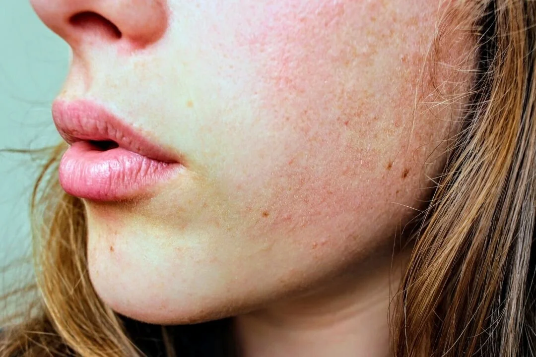 Best Tips for Dry Skin — Moody Sisters Skincare