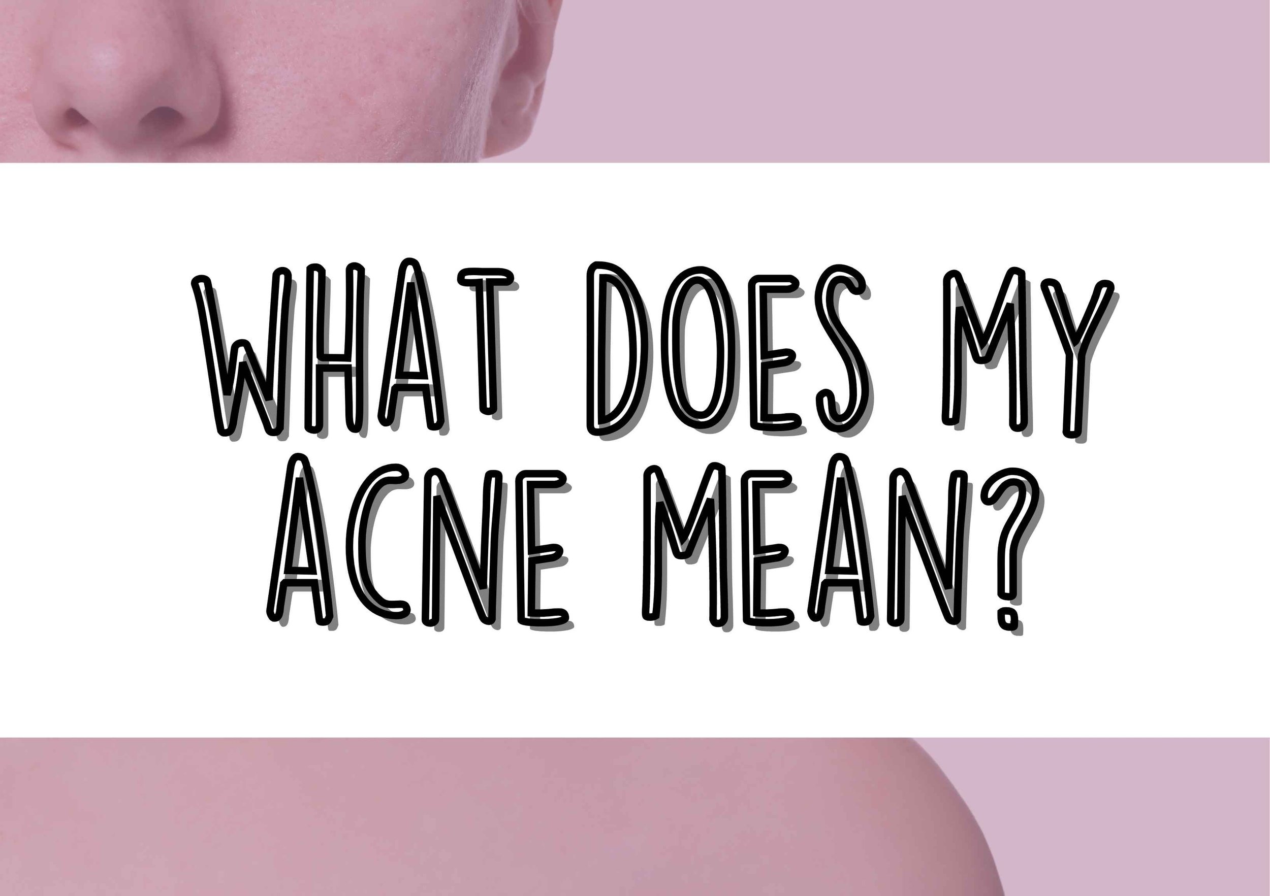 What does my acne mean? — Moody Sisters Skincare