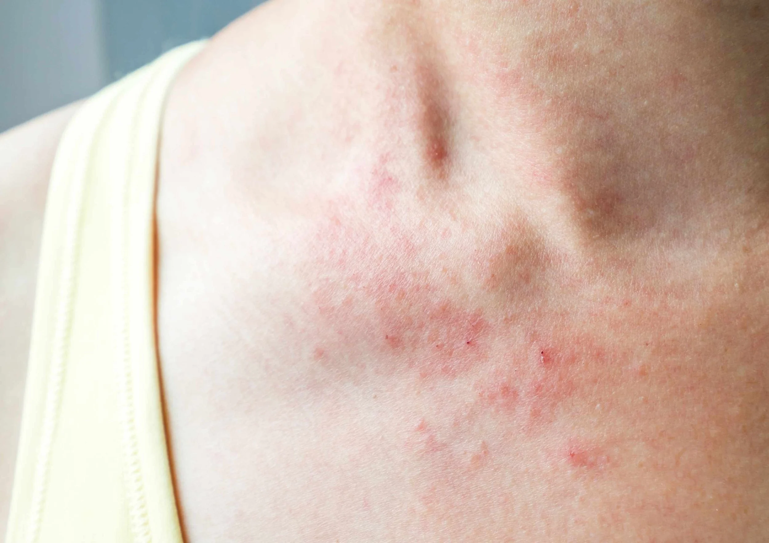 Why is My Skin so Sensitive? — Moody Sisters Skincare