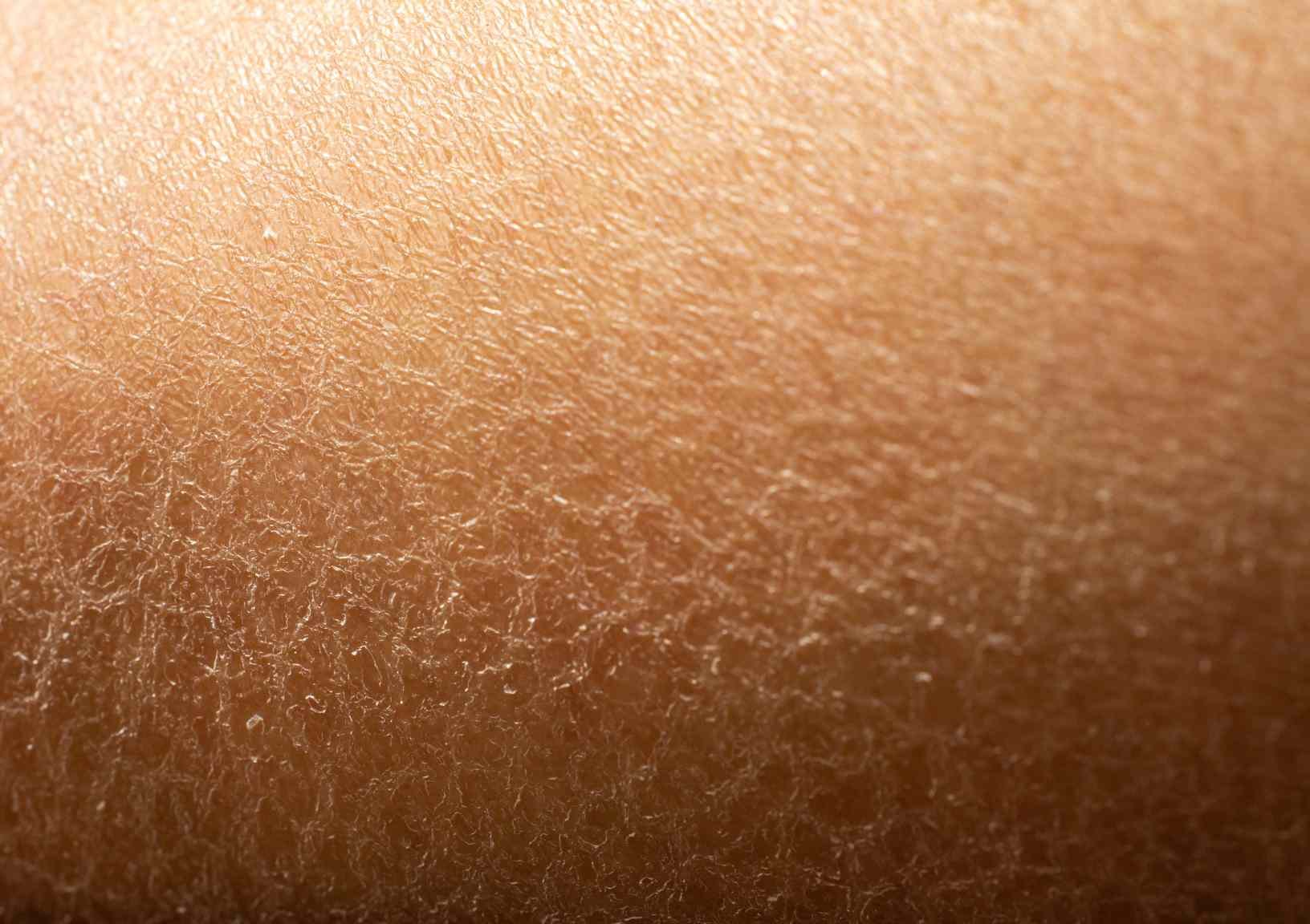 How To Get Rid Of Dry Skin On Legs — Moody Sisters Skincare