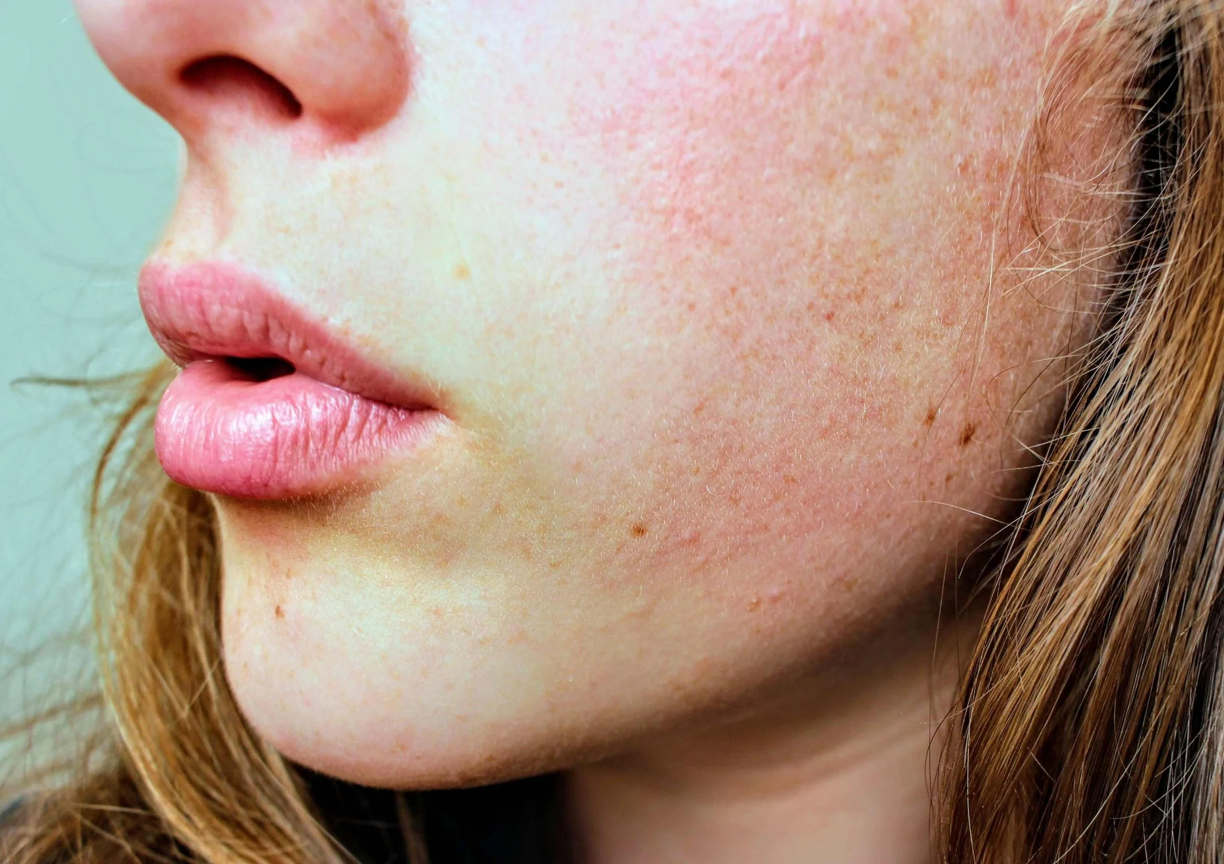 Why Do I Have Dry Patches Of Skin On The Face And Body Moody Sisters