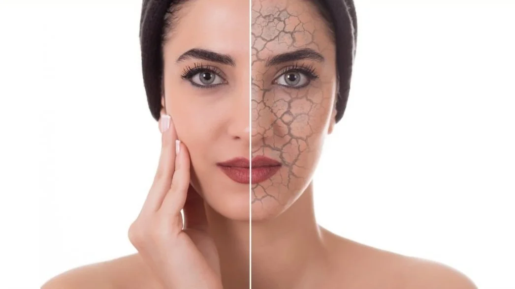 How to Treat Dry Skin in Summer — Moody Sisters Skincare