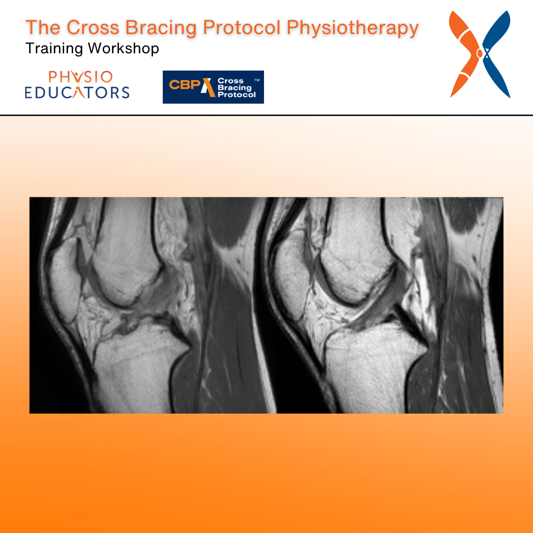 Cross Bracing Workshop with Jane Rooney — Physio Educators