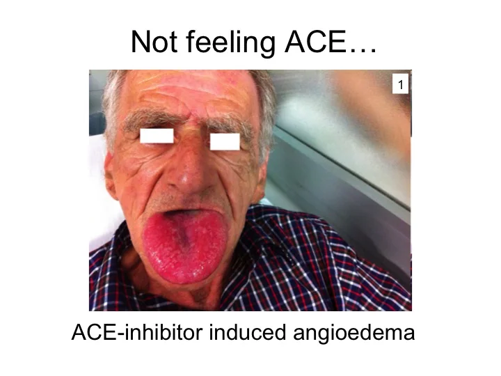 Edinburgh Emergency Medicine - ACE-inhibitor Induced Angioedema