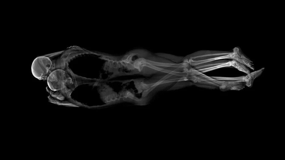 X-Ray Portraits of Couples by Saiko Kanda and Mayuka Hayashi — COCI