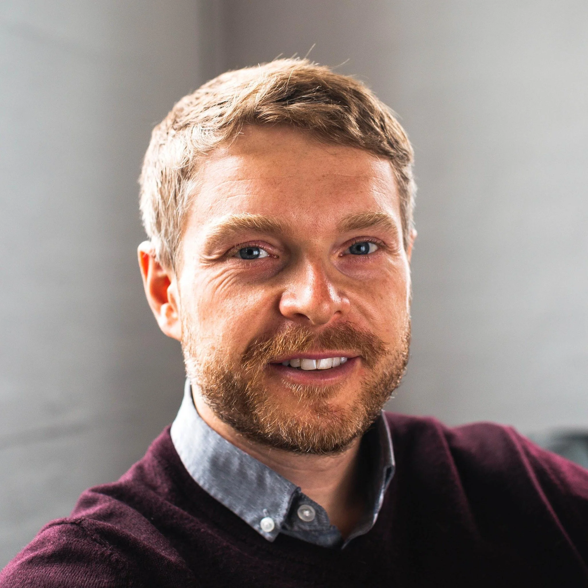 Blake Anderson Without Hair