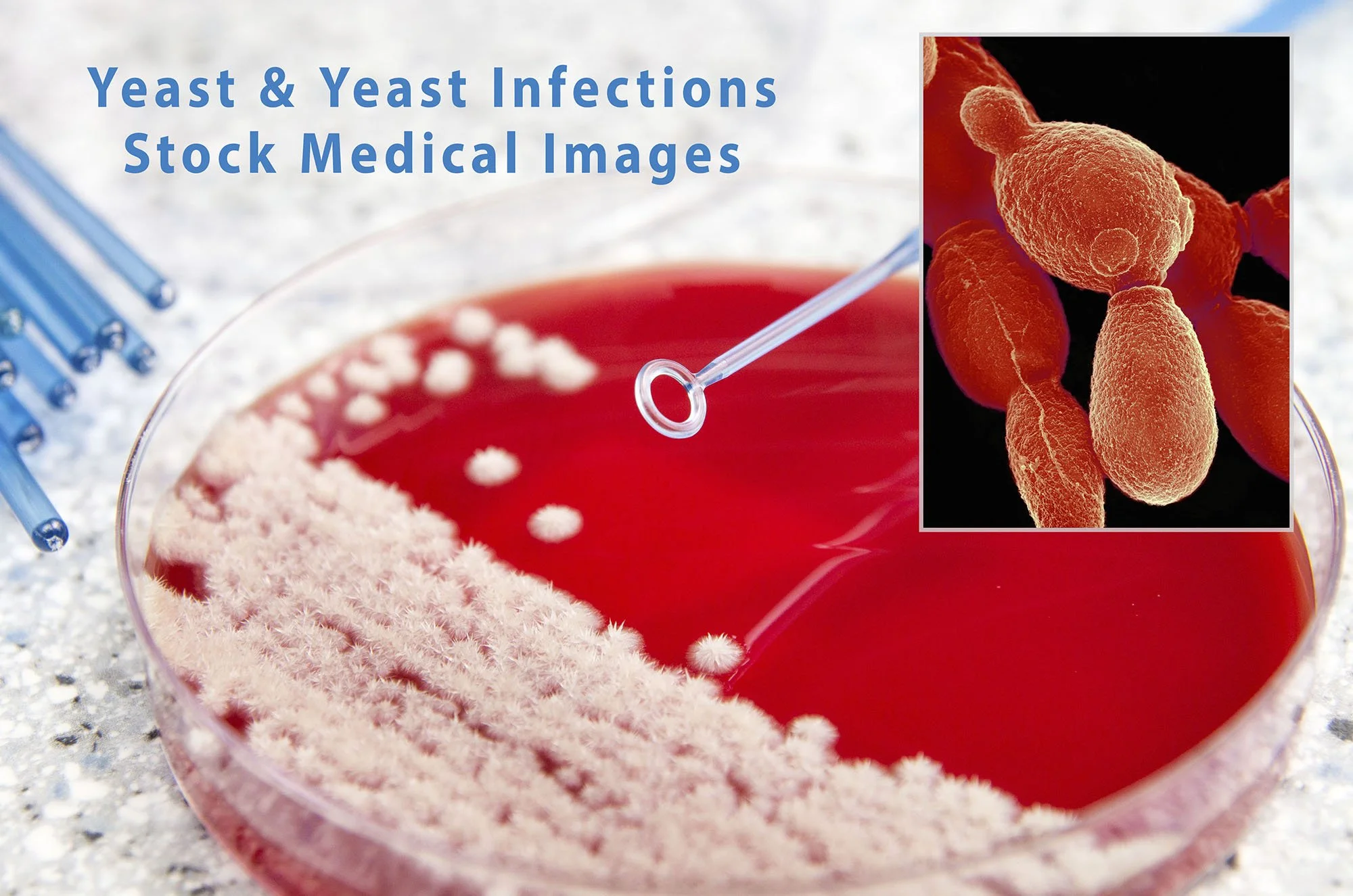 Candida Albicans Yeast And Fungus In And On The Human Body — Science And Medical Stock Images