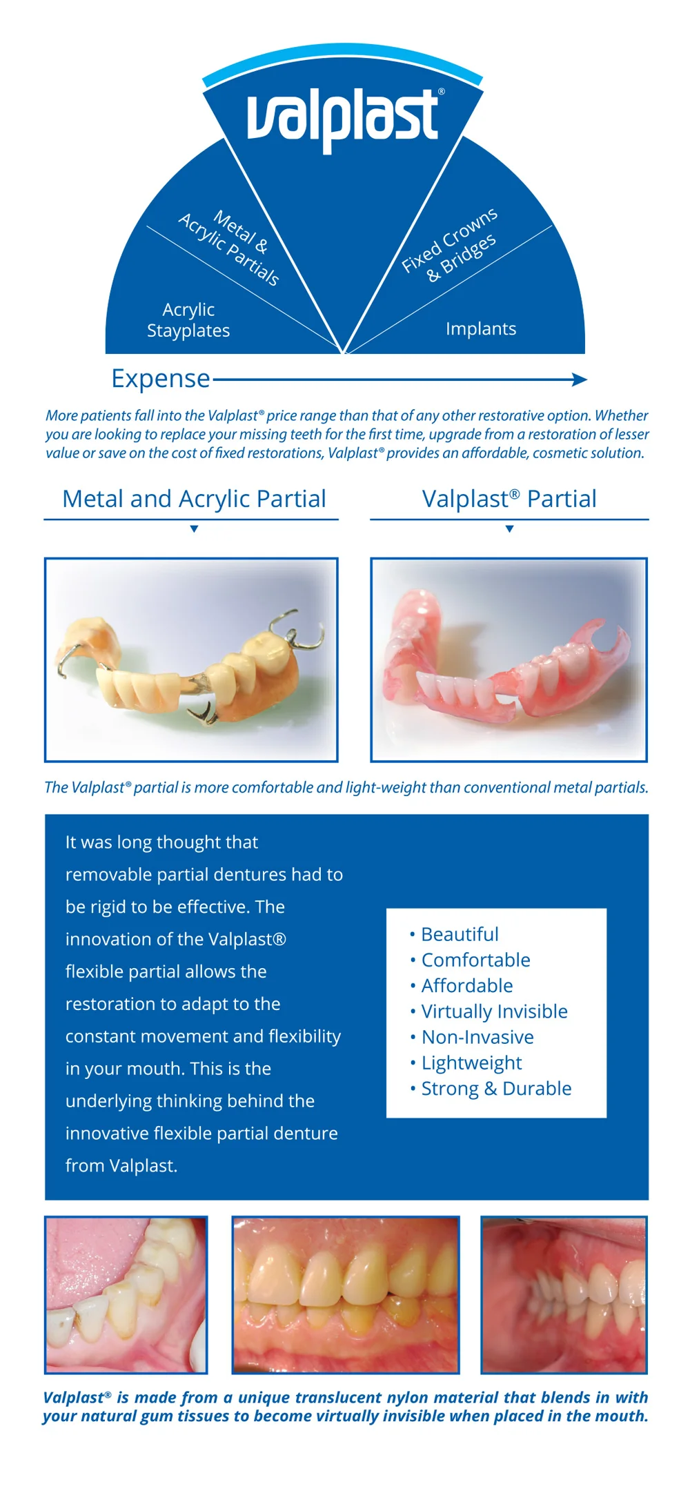 Patients Valplast Flexible Partials