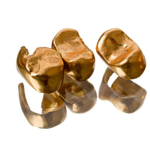 Gold Dental Scrap Refiner — Reclaim, Recycle, and Sell your Precious ...