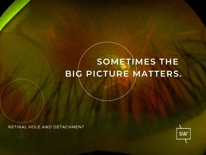 Stonewire Optometry | Edmonton Eye Care Tip of the Week-Sometimes the ...