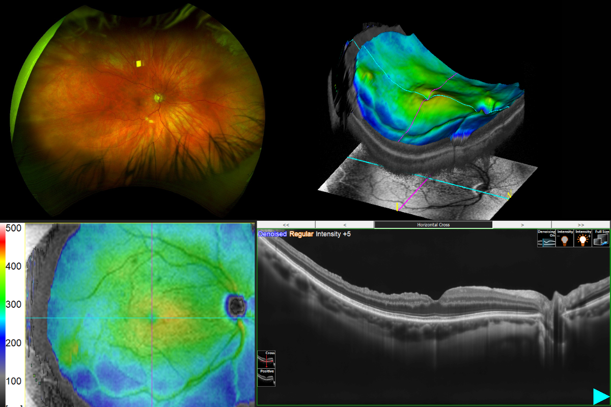 Stonewire Optometry | Dr. Ross McKenzie, Optometrist | Edmonton | Eye Doctor Near Me