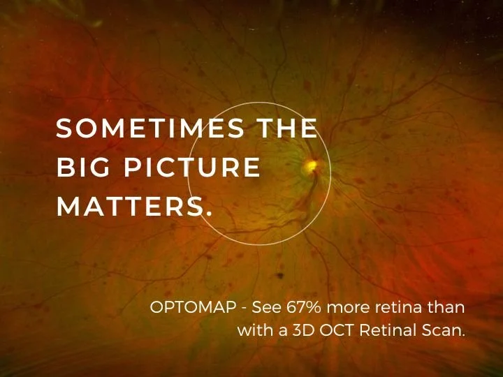 Stonewire Optometry | Ultra-Widefield Digital Retinal Imaging Eye Exam