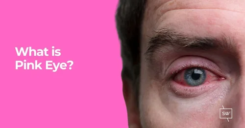Stonewire Optometry | Edmonton's Eye Care Blog - Pink Eye & How to Treat It