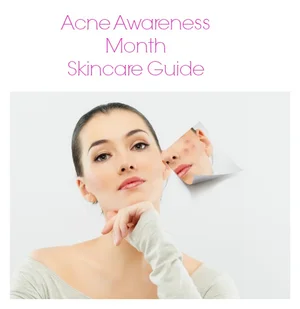Acne Awareness Month Skincare Guide — Posh Lifestyle & Beauty Blog