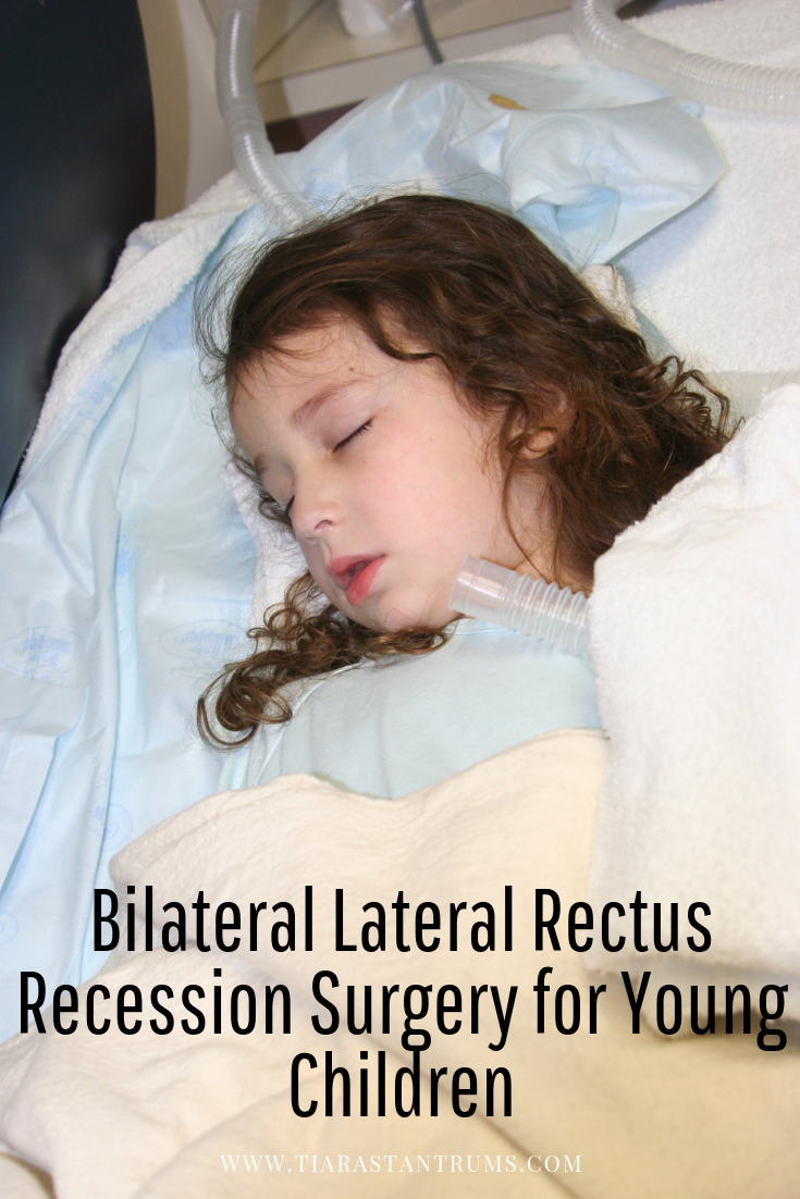Bilateral Lateral Rectus Recession Surgery for Young Children — Tiaras ...