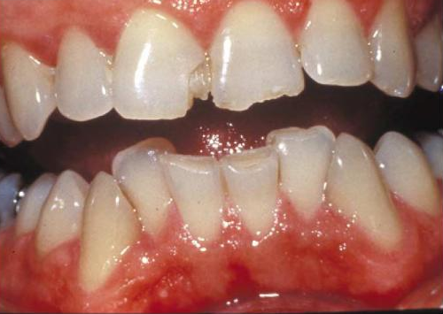 A Closer Look At The Ted Bundy Case — Mike Tabor