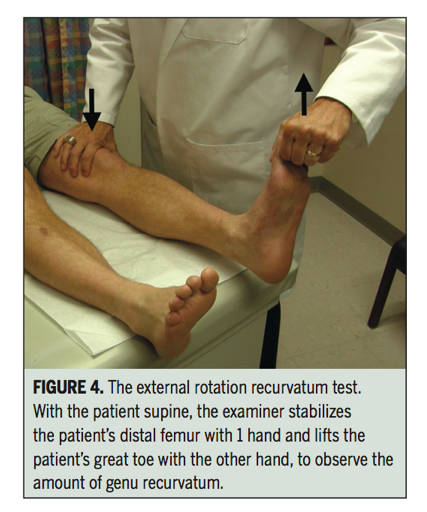 Injuries to the posterolateral corner of the knee — Rayner & Smale