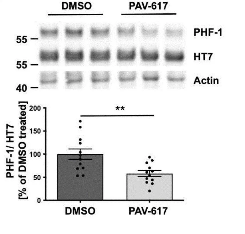 Neuroscience Programs — Prosetta Biosciences