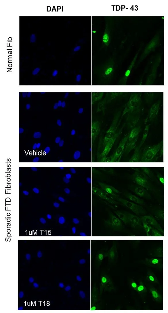 Neuroscience Programs — Prosetta Biosciences