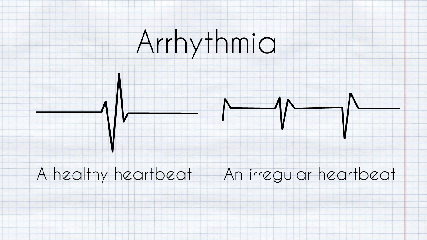 A Beginners Guide To Heart Disease