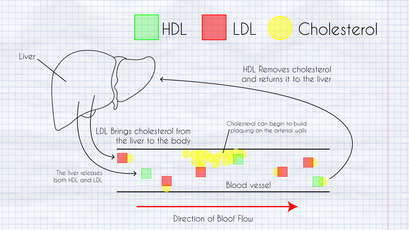 Cholesterols Role In Heart Disease