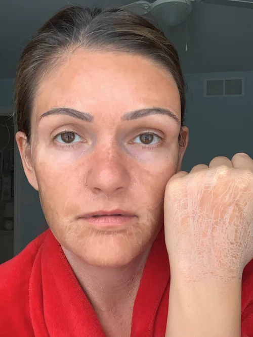 Unbiased, Unpaid, Blunt Review of the Creepy Hanacure Face Mask ...