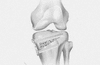 Dr Christopher Vertullo : Knee Surgeon, Gold Coast Australia Specialist ...