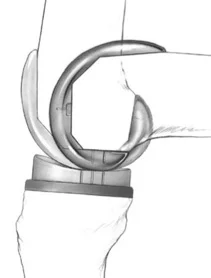 Dr Christopher Vertullo : Knee Surgeon, Gold Coast AustraliaDr ...