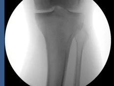 Dr Christopher Vertullo : Knee Surgeon, Gold Coast AustraliaDr ...