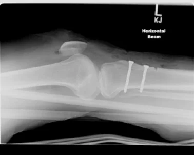 Dr Christopher Vertullo : Knee Surgeon, Gold Coast AustraliaDr ...