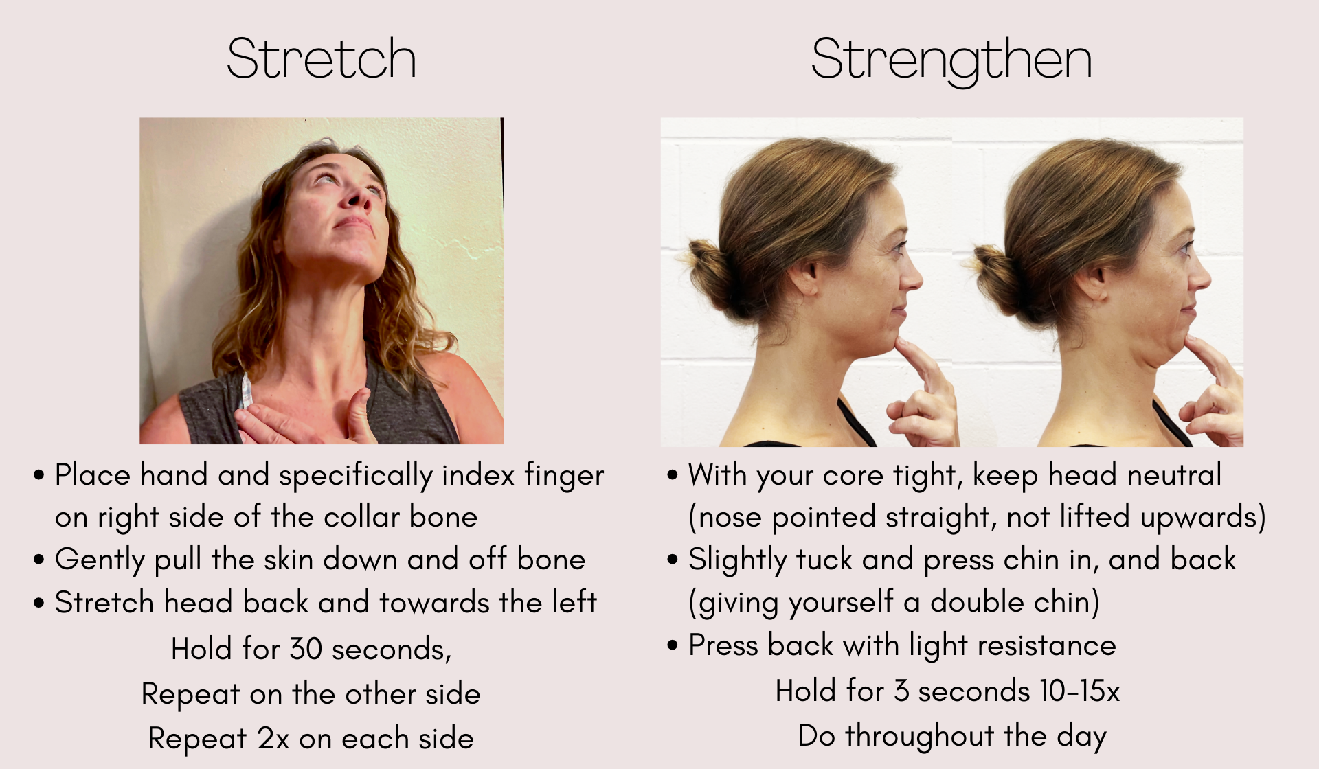 Forward Head Posture — Body Align