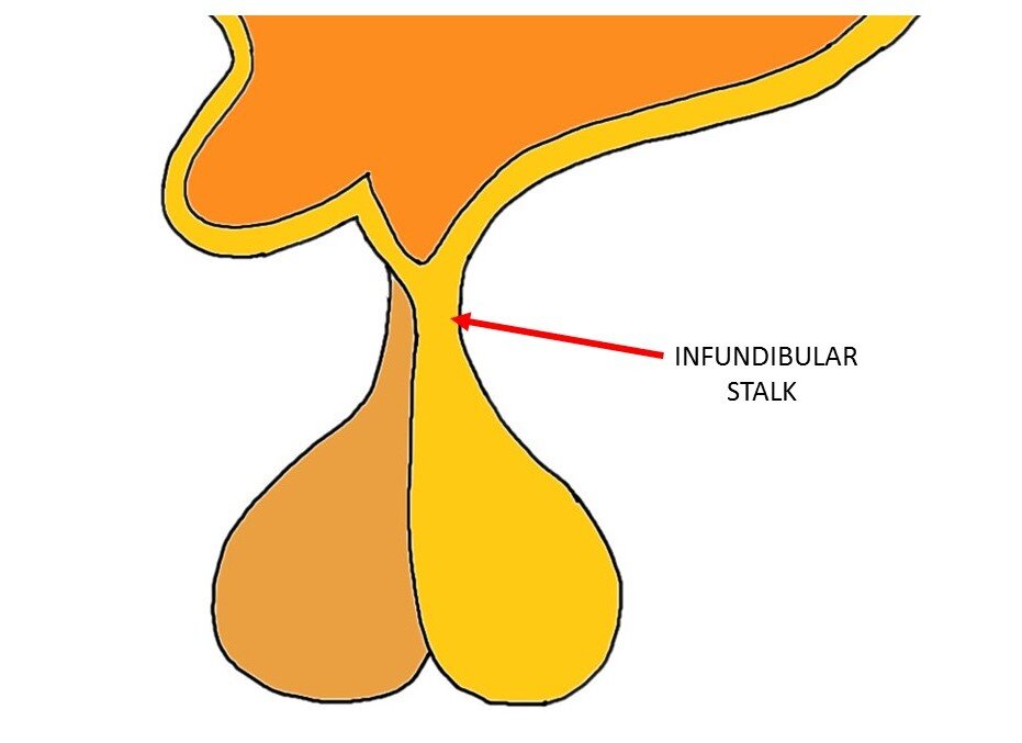 Infundibular stalk - definition — Neuroscientifically Challenged