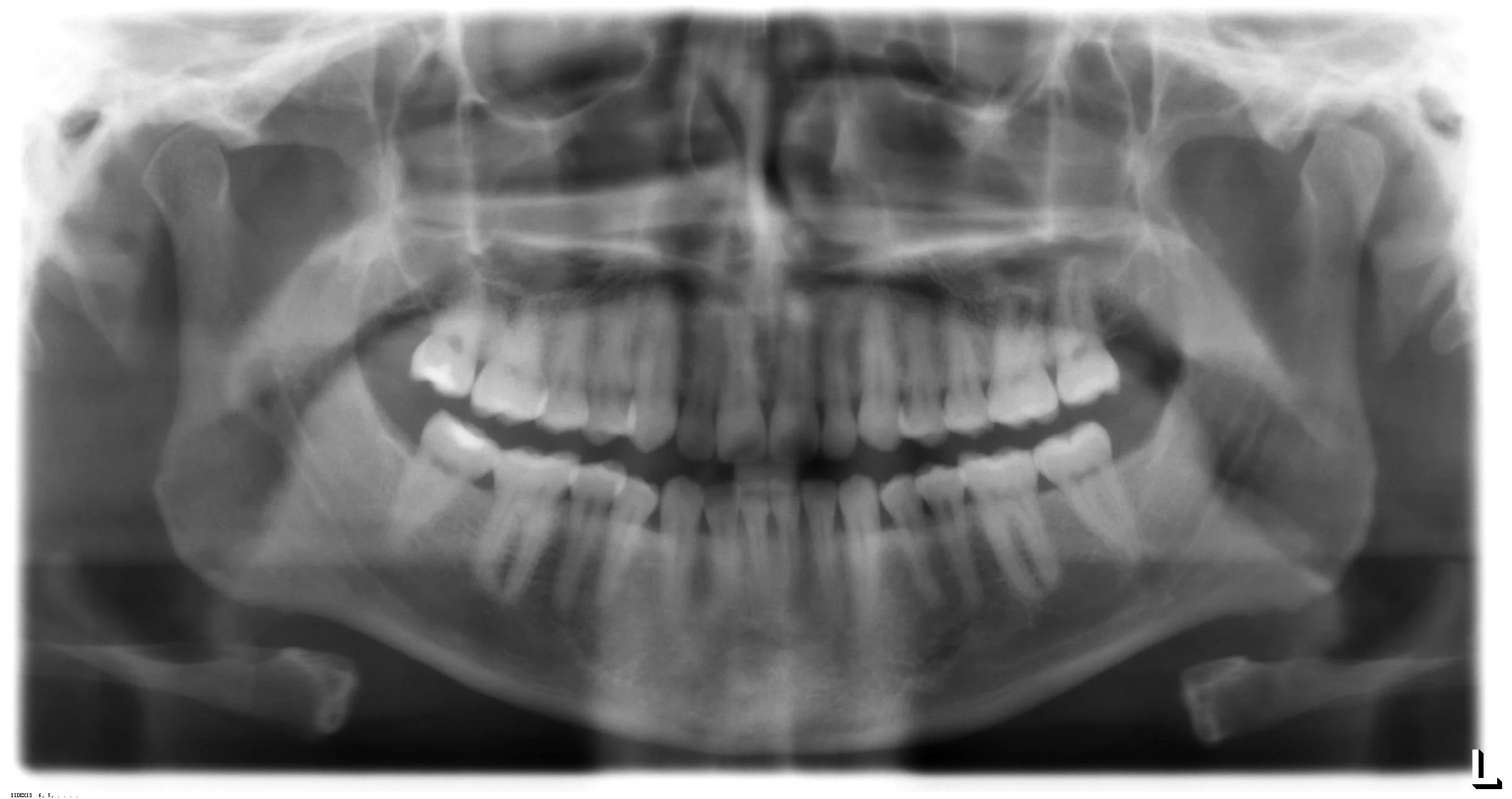 3D CT — Tri-State Oral and Maxillofacial Surgery