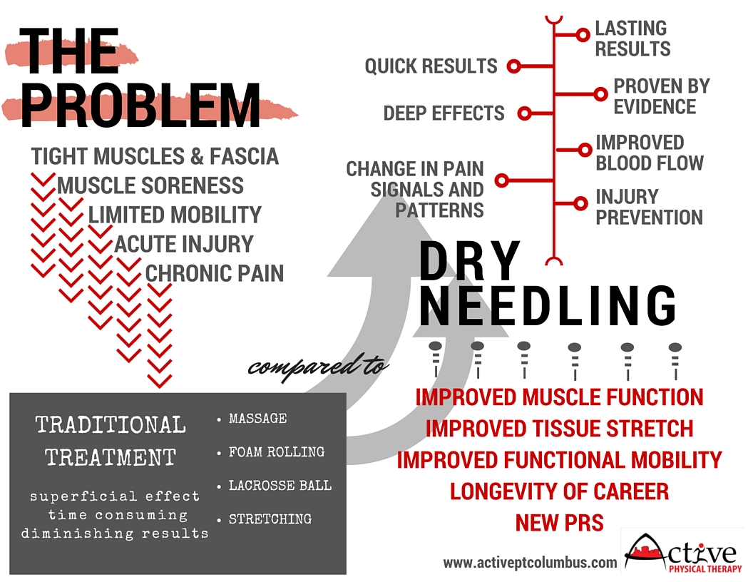Dry Needling Adelaide — Kinfolk Physiotherapy & Wellness