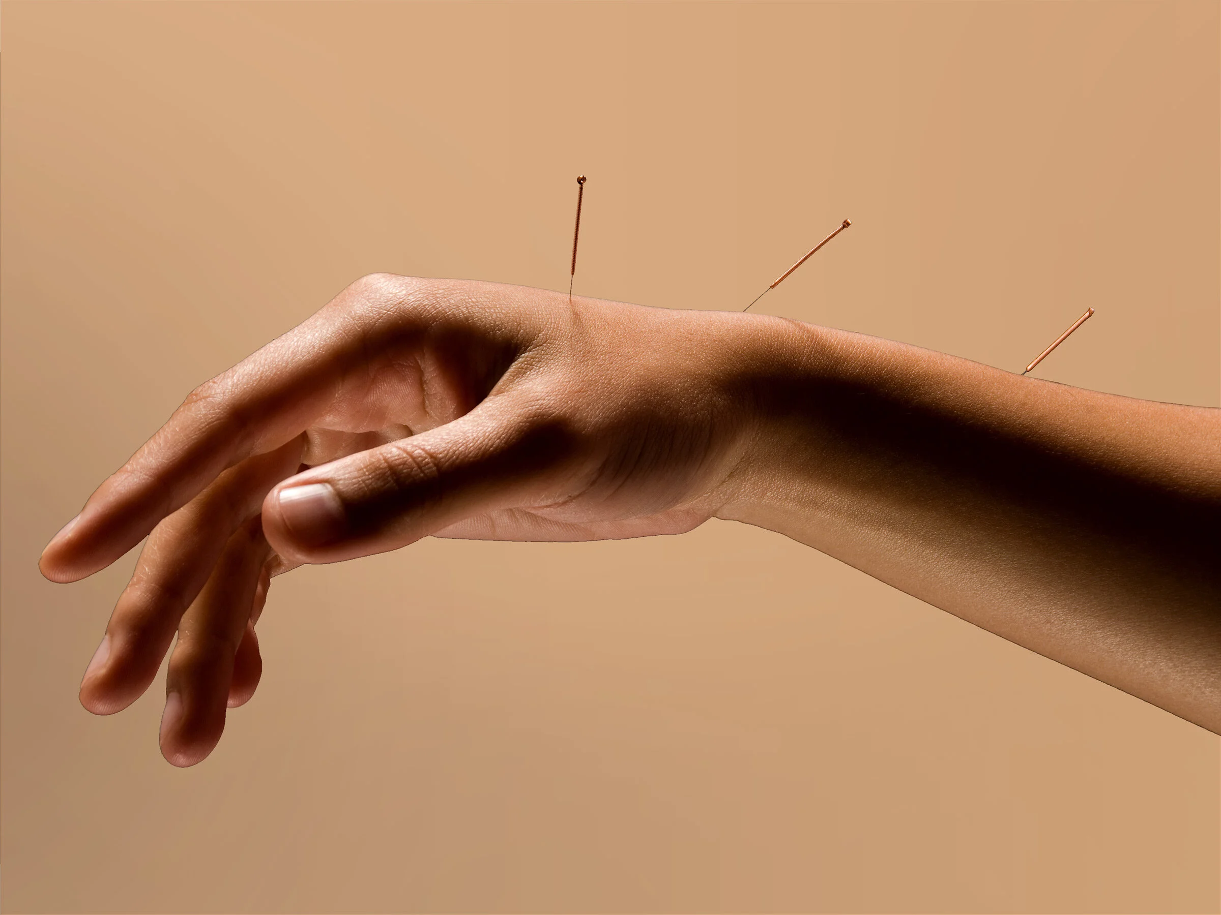Acupuncture