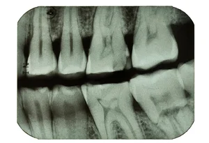 The Truth About Dental X-Rays — Dr. Scott Solomons