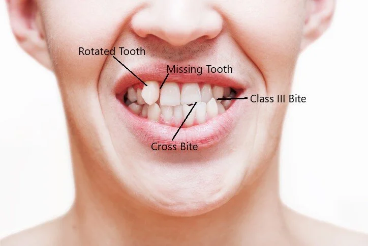 How Dentists Assess the Need for Adult Orthodontics — Dr. Scott Solomons