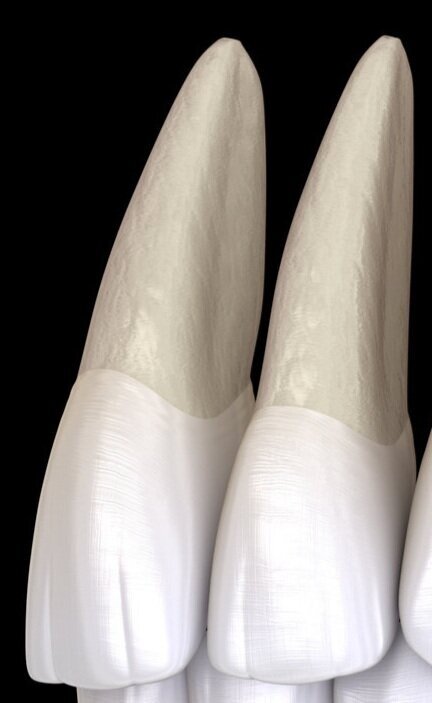 The Types of Teeth We Have and Their Functions — Dr. Scott Solomons