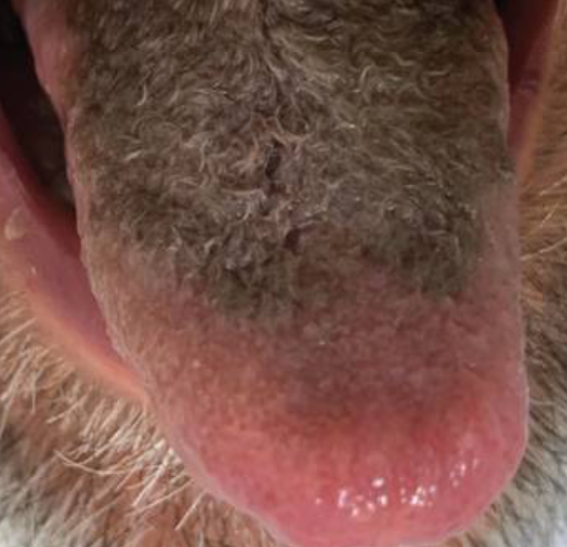 Hairy Tongue — Dr. Scott Solomons