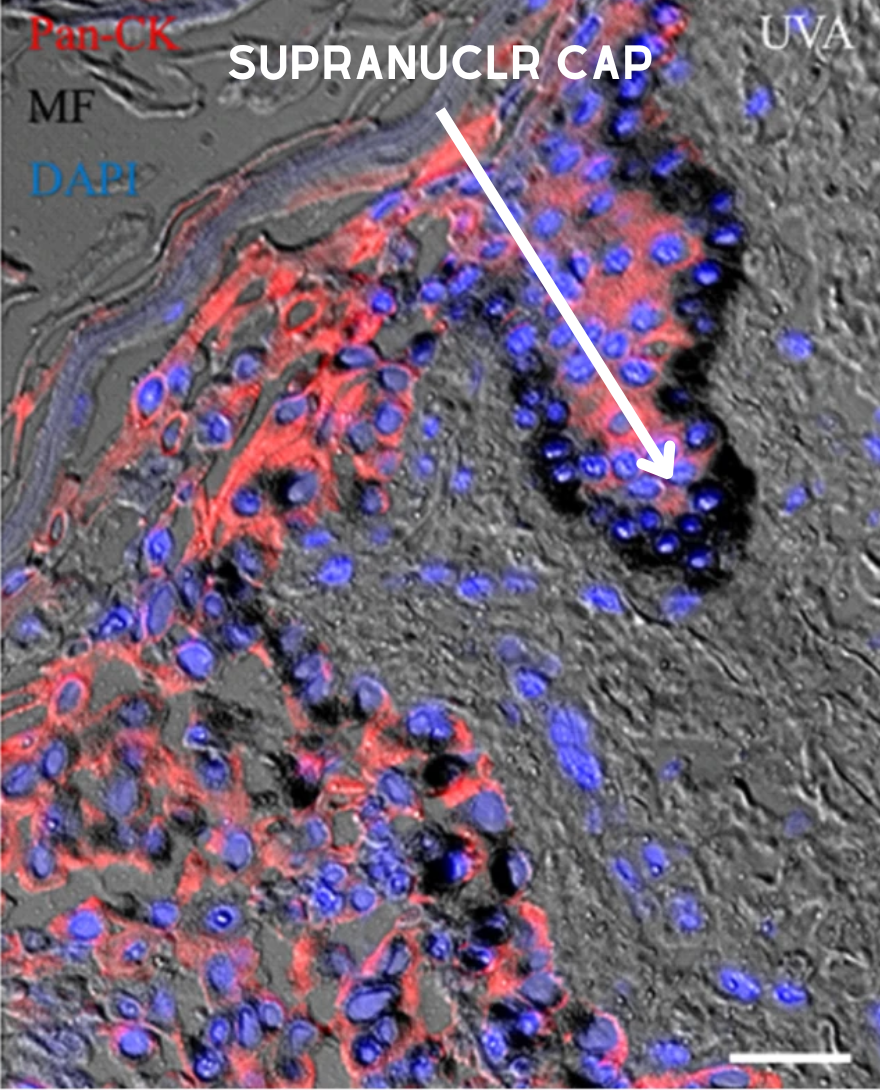 How And Why We Tan — Dr. Scott Solomons