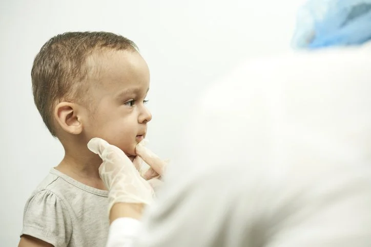 Understanding Anterior Open Bites: Causes, Effects, and Treatment ...