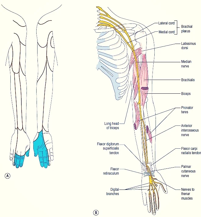 What's making my hand go numb? Part 3 - Peripheral Nerve Disorder ...