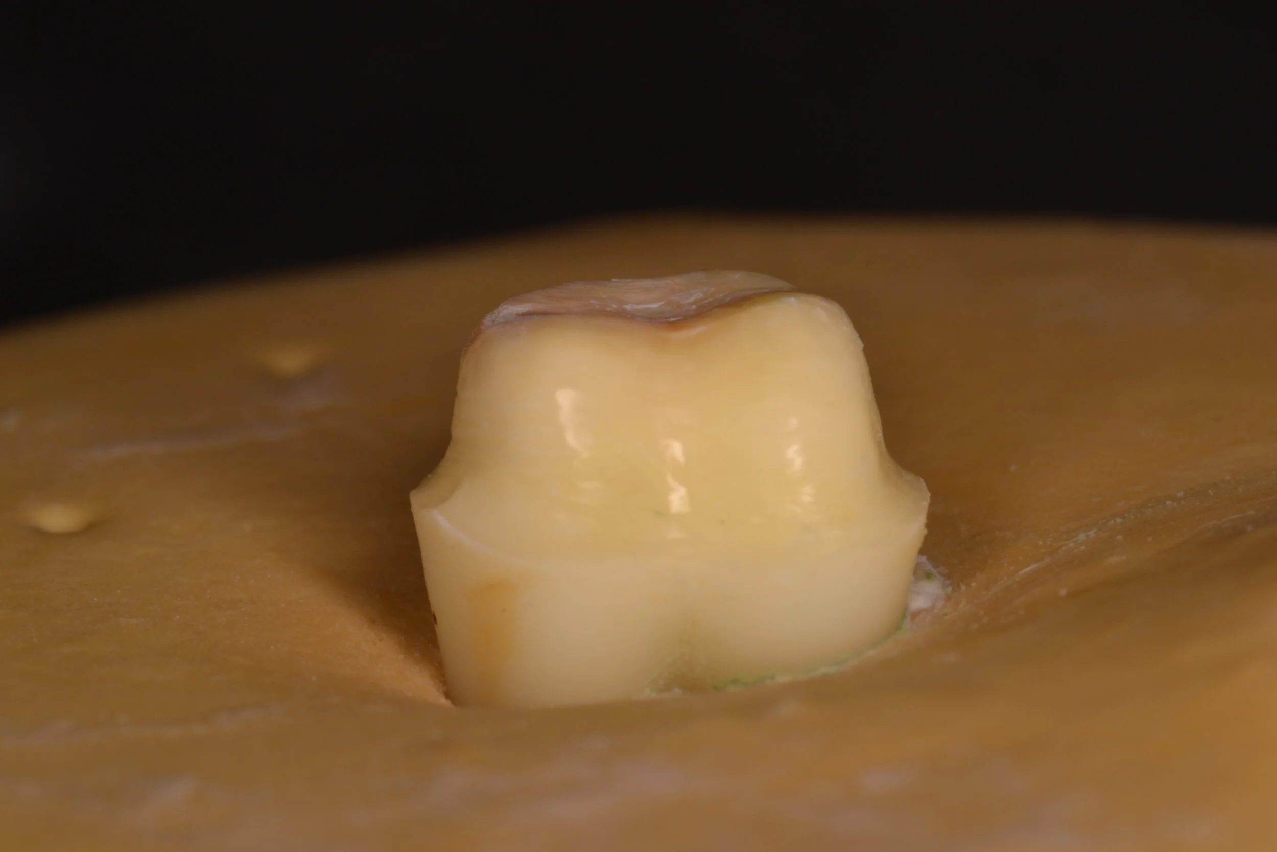 eMax Preparation Guidelines for Posterior Teeth-Renstrom Dental Studio ...