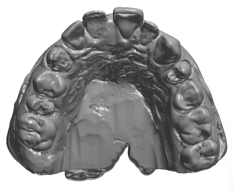 Full Service Digital Dental Laboratory — RENSTROM DENTAL STUDIO, INC.