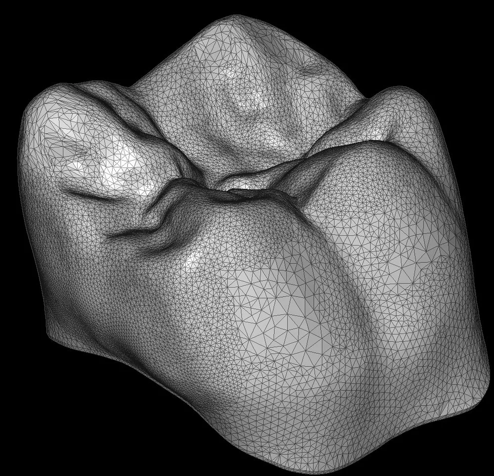 3Shape 3D STL Viewer Software-Renstrom Dental Studio | Full Service ...