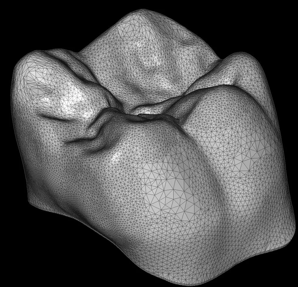 3Shape 3D STL Viewer Software-Renstrom Dental Studio | Full Service ...